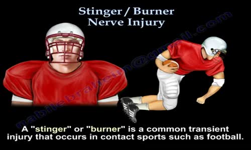 Stinger Burner Nerve Injury Everything You Need To Know Dr. Nabil Ebraheim