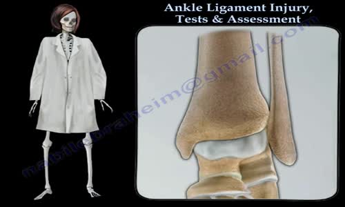 Ankle Ligament Injury Tests & Assessment Everything You Need To Know Dr ...