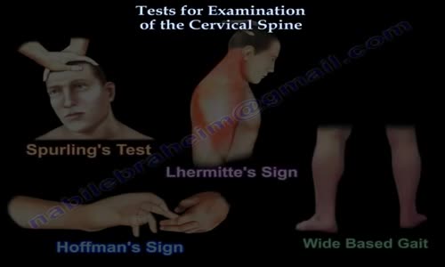 Tests For Examination Of The Cervical Spine Everything You Need To Know ...