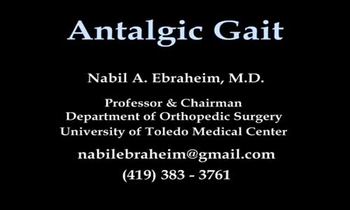 Antalgic Gait Everything You Need To Know Dr. Nabil Ebraheim