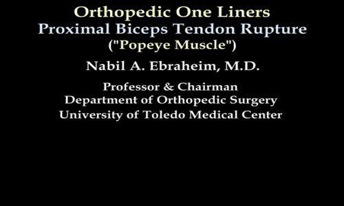 Proximal Biceps Tendon Rupture Popeye Everything You Need To Know Dr ...