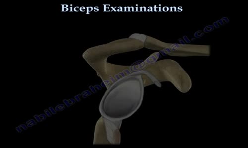 Biceps tendon Injuries, Examinations & Tests Everything You Need To ...