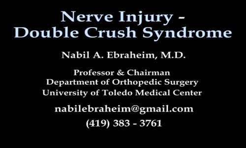 Double Crush Syndrome Everything You Need To Know Dr. Nabil Ebraheim