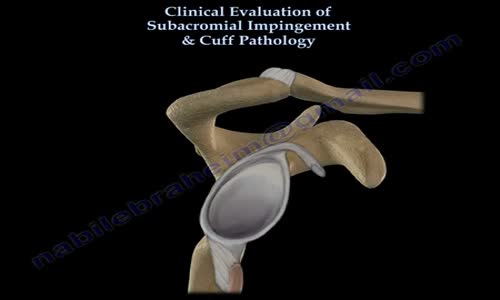 Shoulder Examination Subacromial, Cuff Everything You Need To Know Dr ...