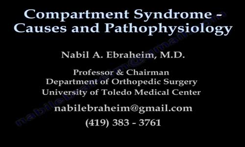 Compartment Syndrome Causes & Pathophysiology Everything You Need To ...