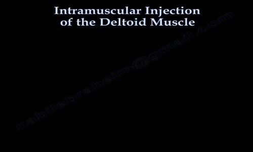 Intramuscular injection of the deltoid muscle Everything You Need To ...