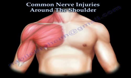 Shoulder Nerve injury ,Injuries Everything You Need To Know Dr. Nabil ...