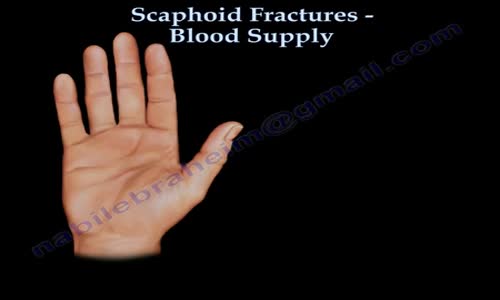 Scaphoid Fractures Blood Supply Everything You Need To Know Dr. Nabil ...