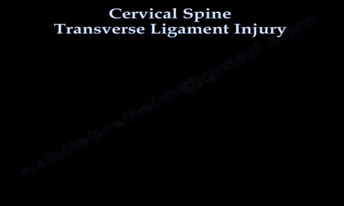 Cervical Spine injury, Transverse Ligament Injury Everything You Need ...